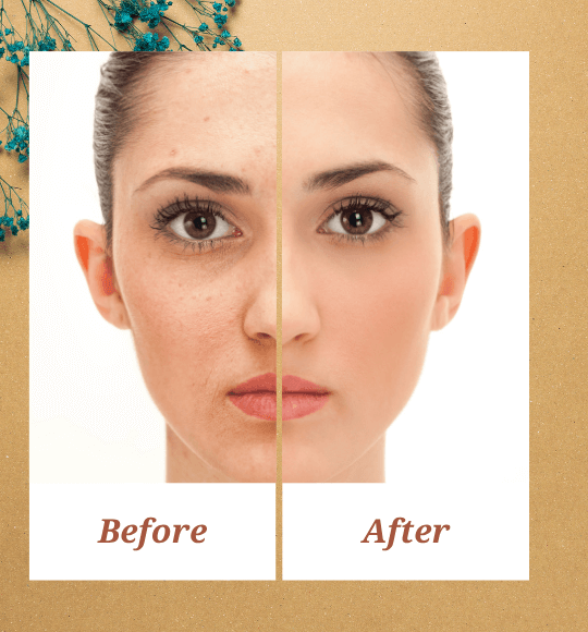 Puffin Whitening Cream – Brighter, Glowing Skin Naturally